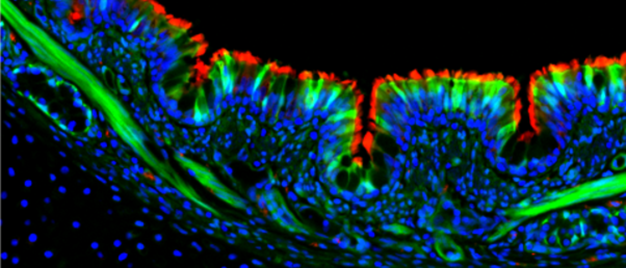 Research | McCray Lab - The University of Iowa